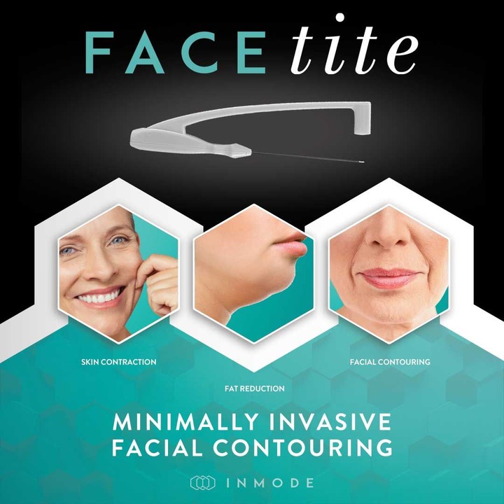 FaceTite Memphis | Plastic Surgery Group of Memphis
