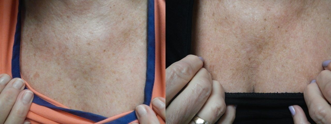 Regenerative Aesthetics Memphis | Dr. Ellis Tavin | PSG