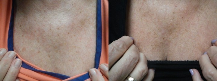 Regenerative Aesthetics Memphis | Dr. Ellis Tavin | PSG